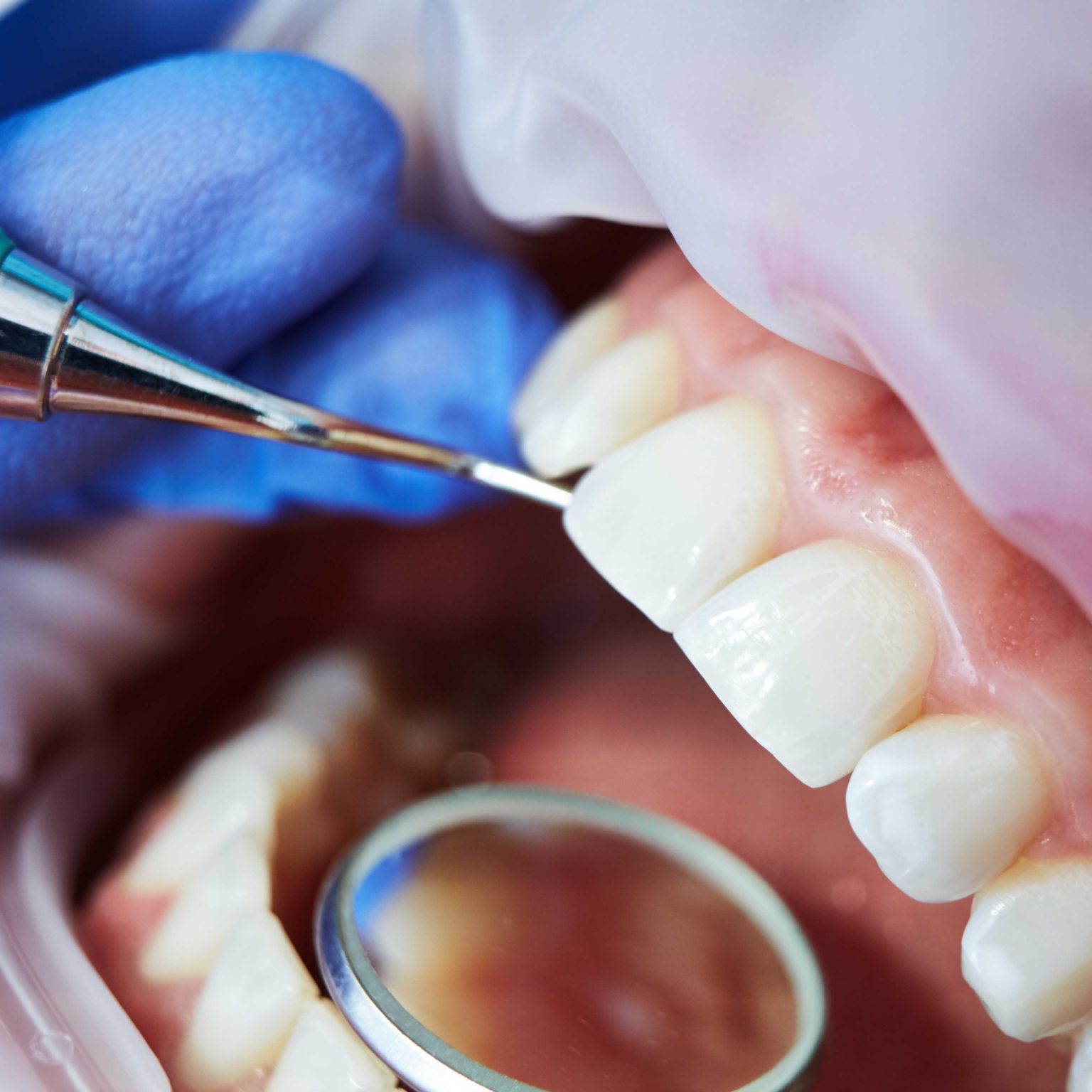 Ormeau Dental » Trusted North Gold Coast Dentists Over 15yrs