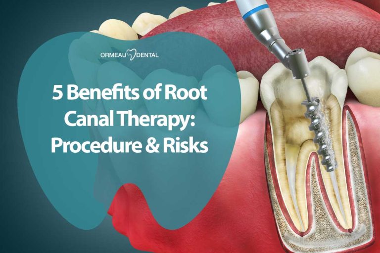 5 Benefits Of Root Canal Therapy: Procedure And Risks