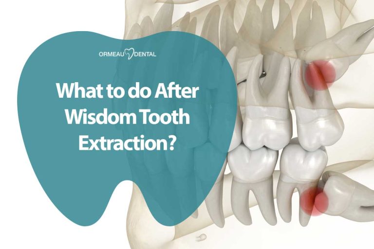 What To Do After Wisdom Tooth Extraction? » Ormeau Dental
